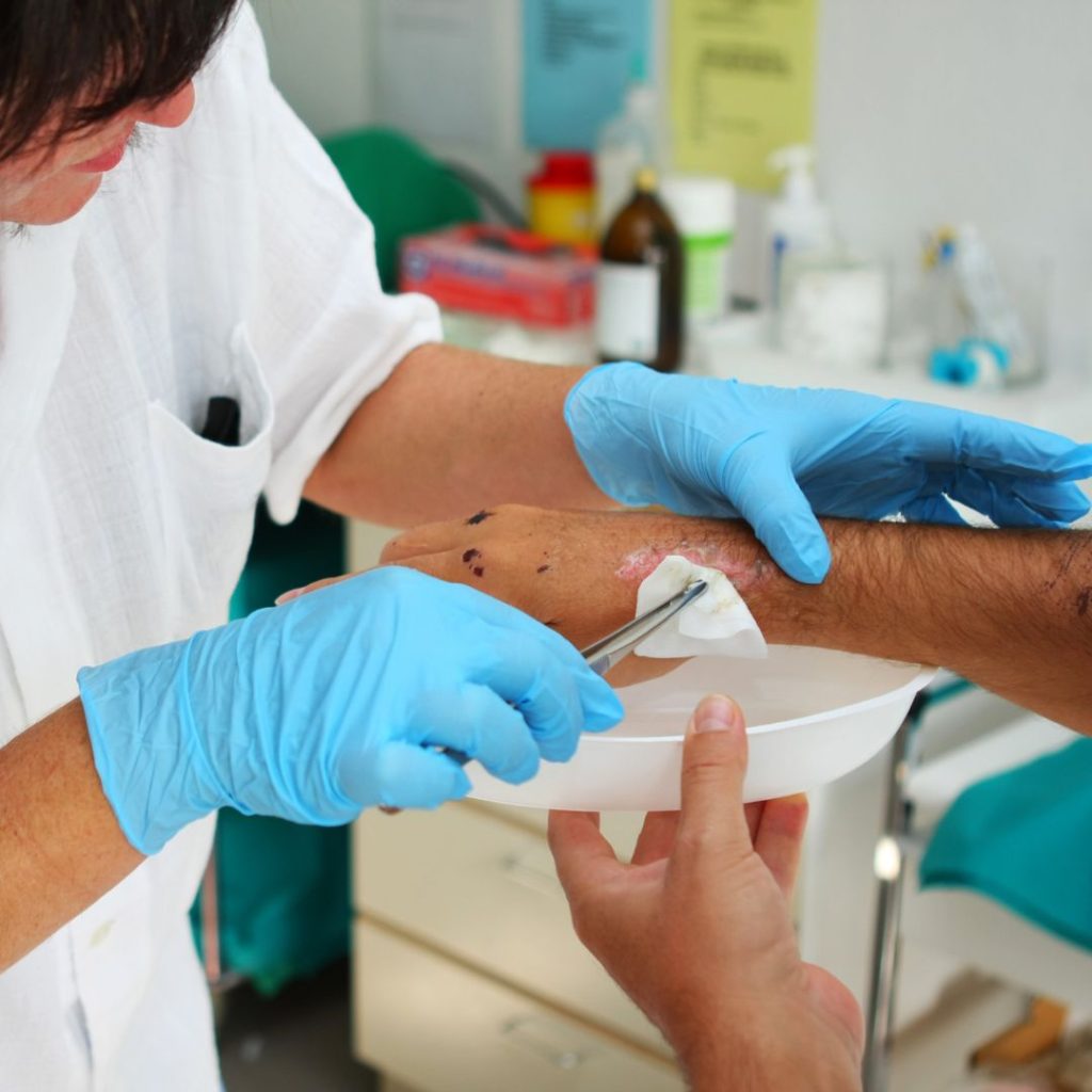 Complex Wound Care Services in Sydney - Uprety Home Care